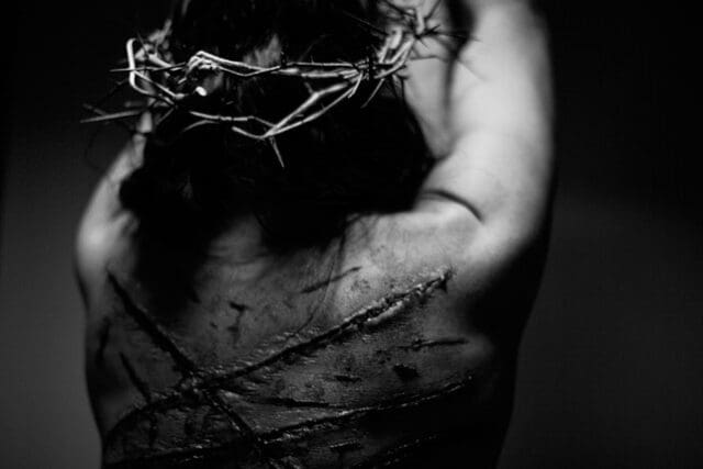 By His Stripes We Are Healed: The Essence of All Healing